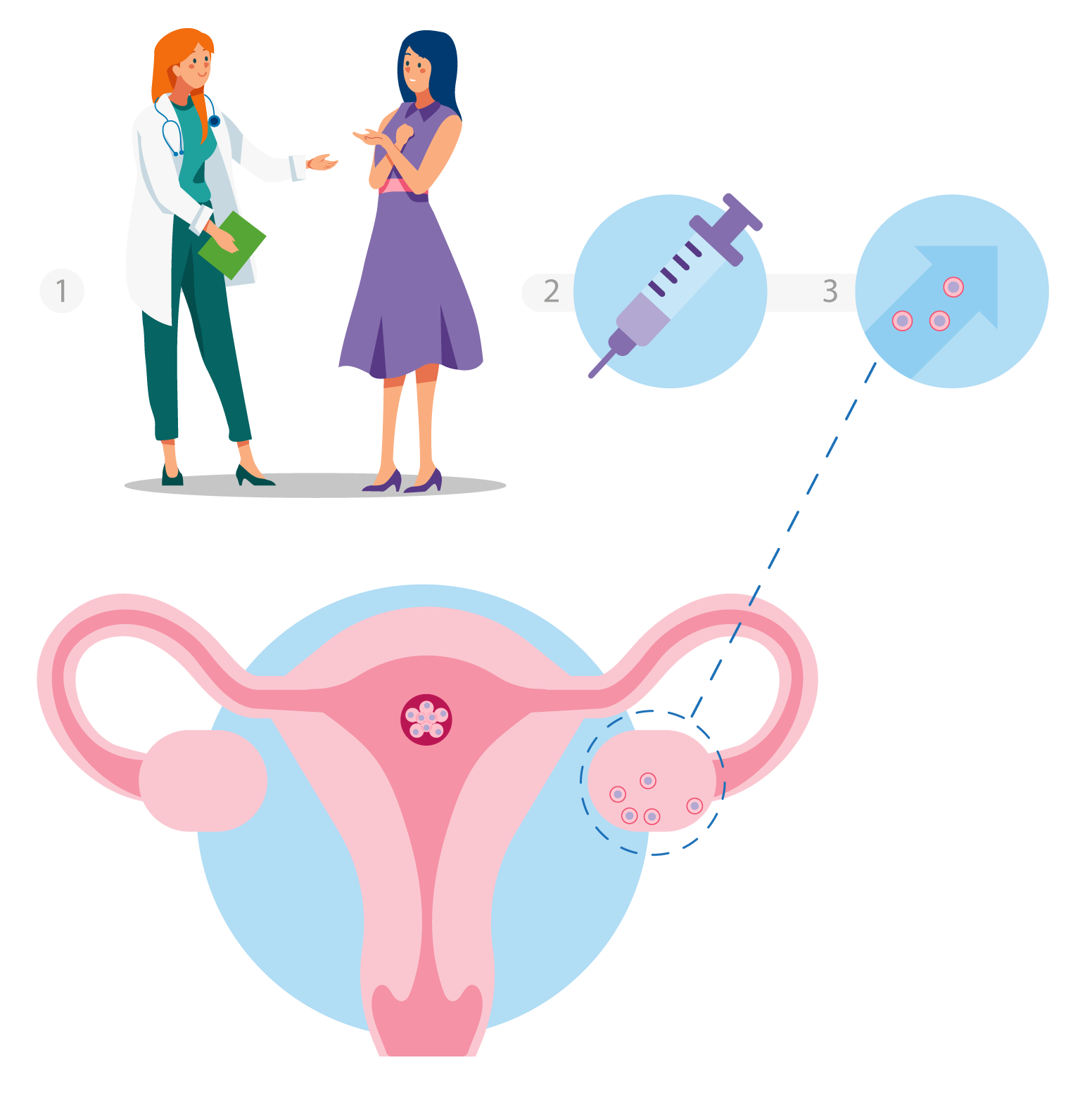 Fertility Preservation Services in San Francisco & Sacramento | Kaiser ...